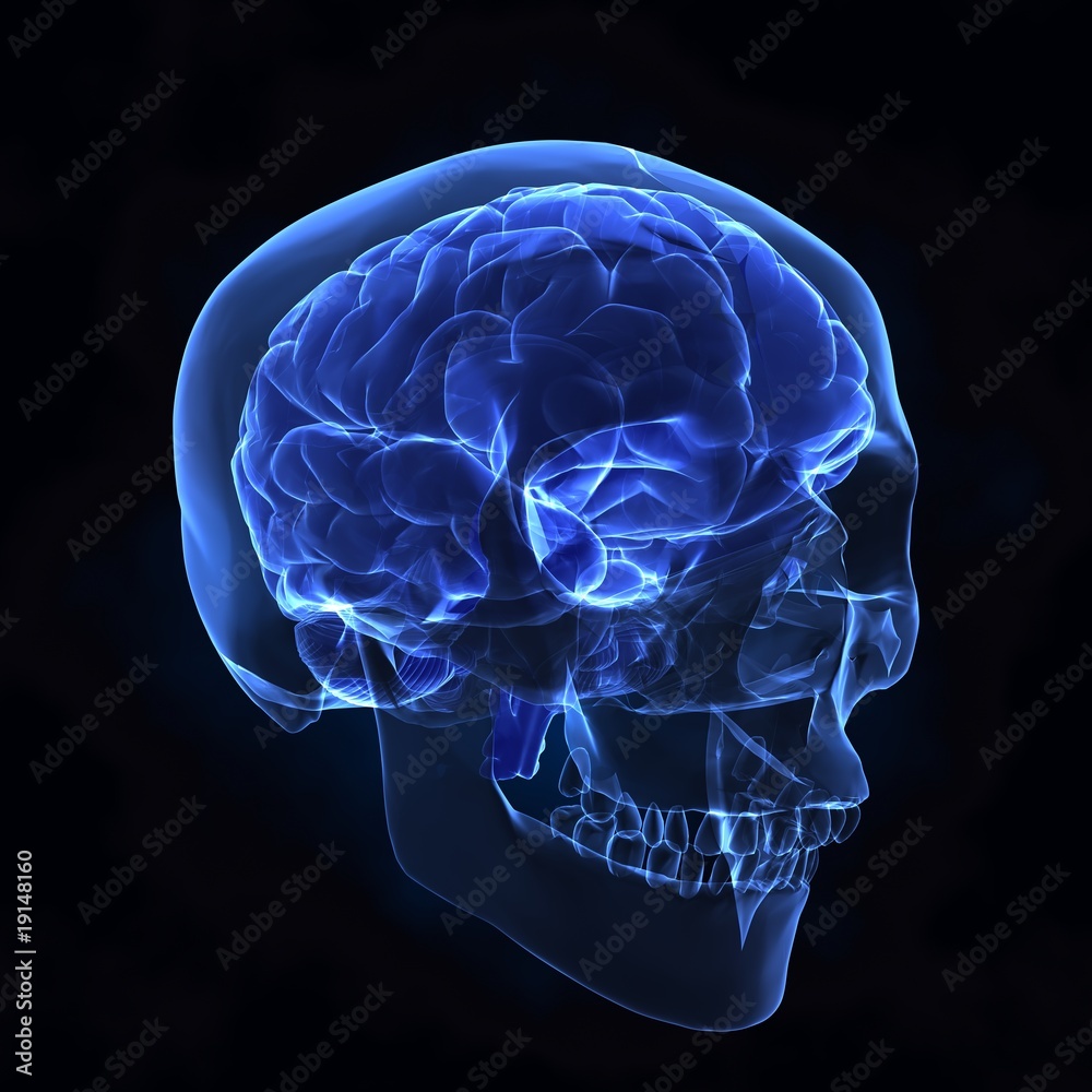 X Ray Brain Front