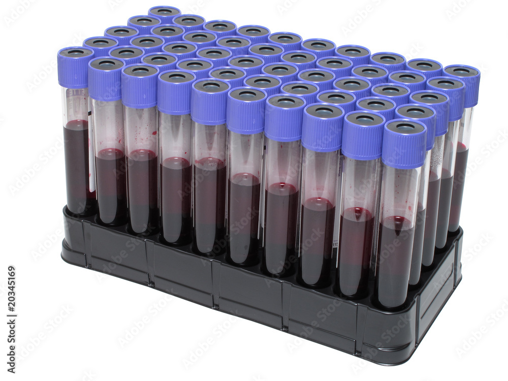 Vacuum venipuncture test tubes with blood. Stock Photo | Adobe Stock