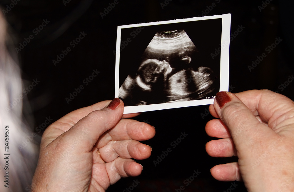 Ultraschallbild Stock-Foto | Adobe Stock