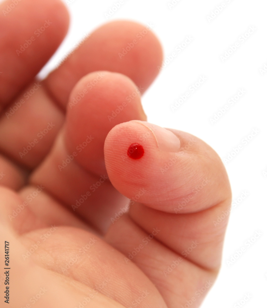 Bleeding finger Stock Photo | Adobe Stock