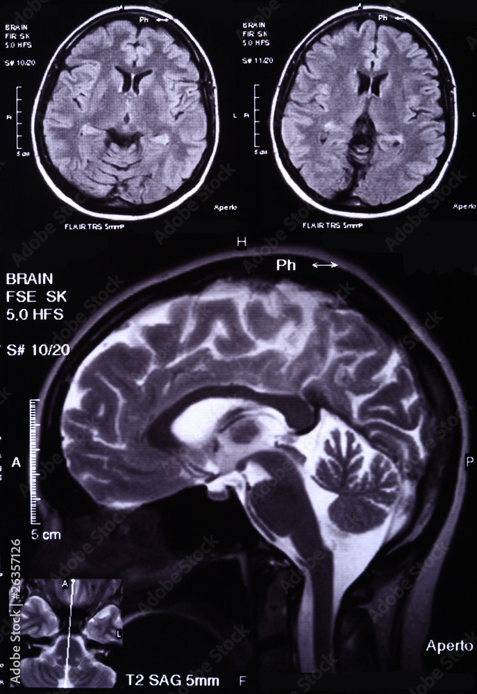 X-ray image of the brain Stock Photo | Adobe Stock
