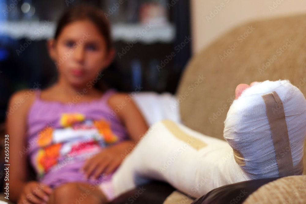 Girl With A Broken Leg Stock Photo | Adobe Stock