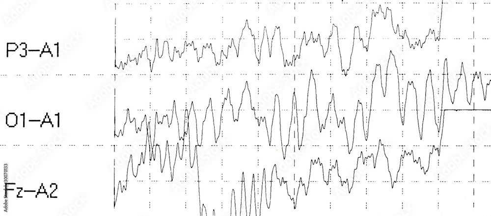 graph brain wave EEG isolated on white background Stock Photo | Adobe Stock