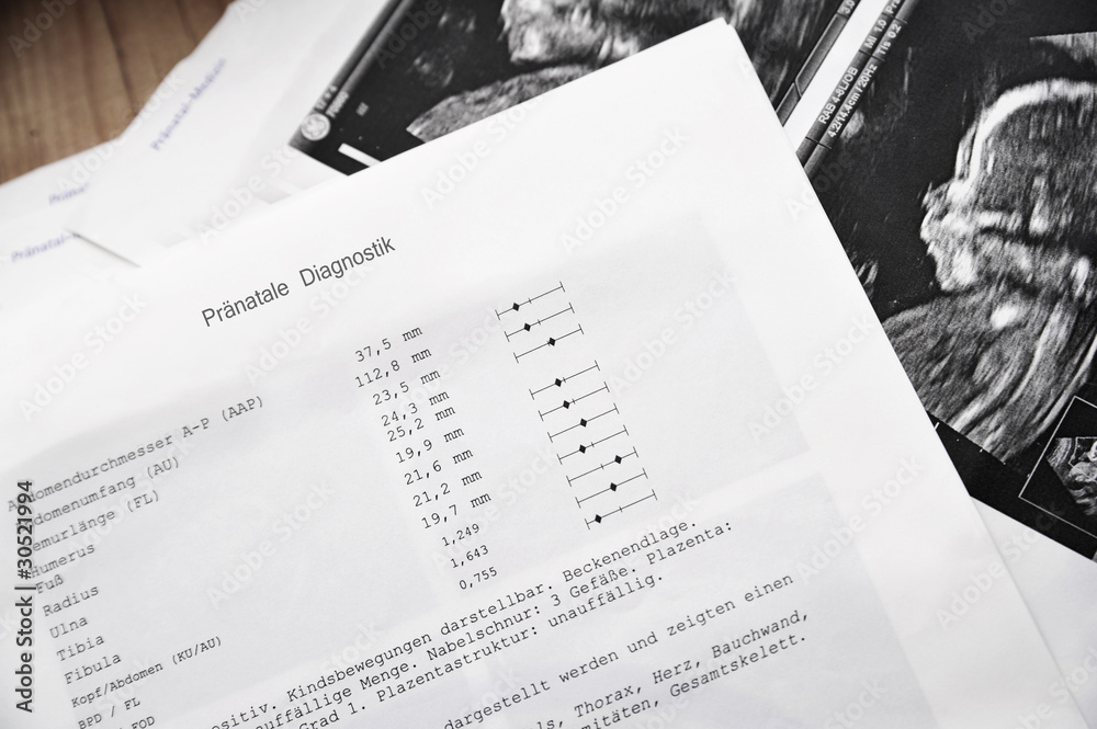 Pränatale Diagnostik Stock-Foto | Adobe Stock