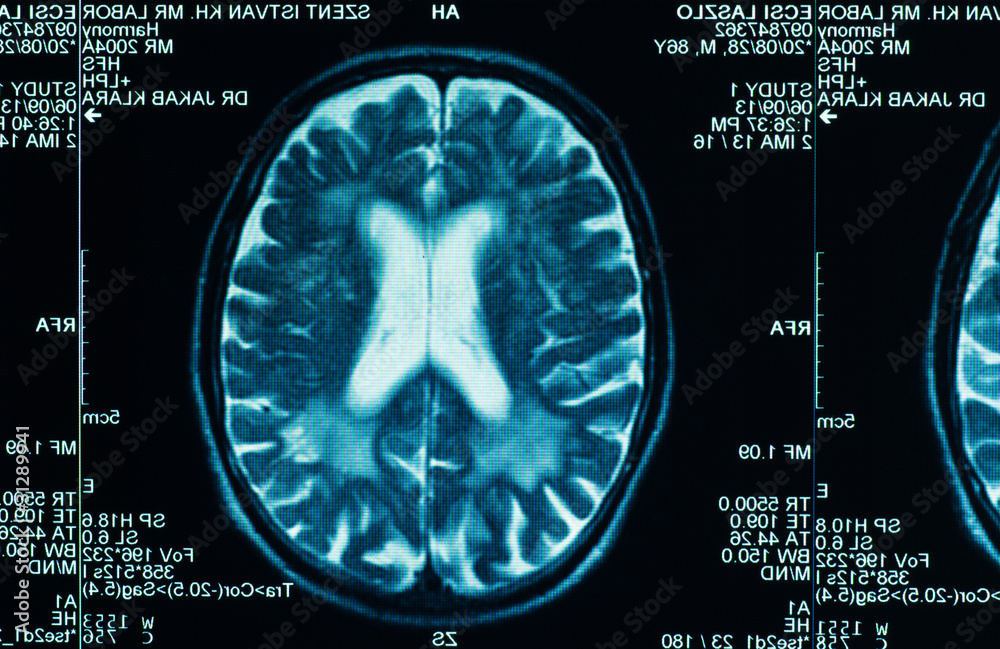 sharp ct scan of the human brain Stock Photo | Adobe Stock