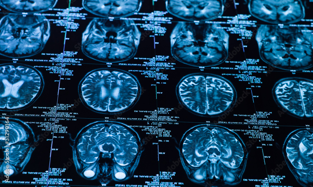 sharp ct scan of the human brain Stock Photo | Adobe Stock