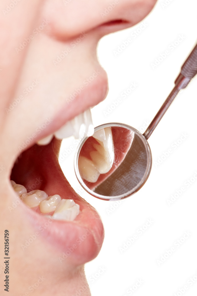 Untersuchung beim Zahnarzt Stock Photo | Adobe Stock