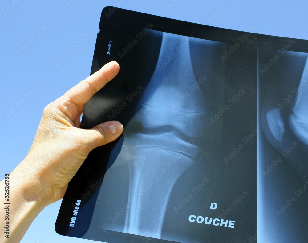 radiologie articulation genou Stock Photo | Adobe Stock