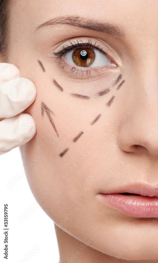 Correction lines on woman face, before surgery operetion Stock Photo ...
