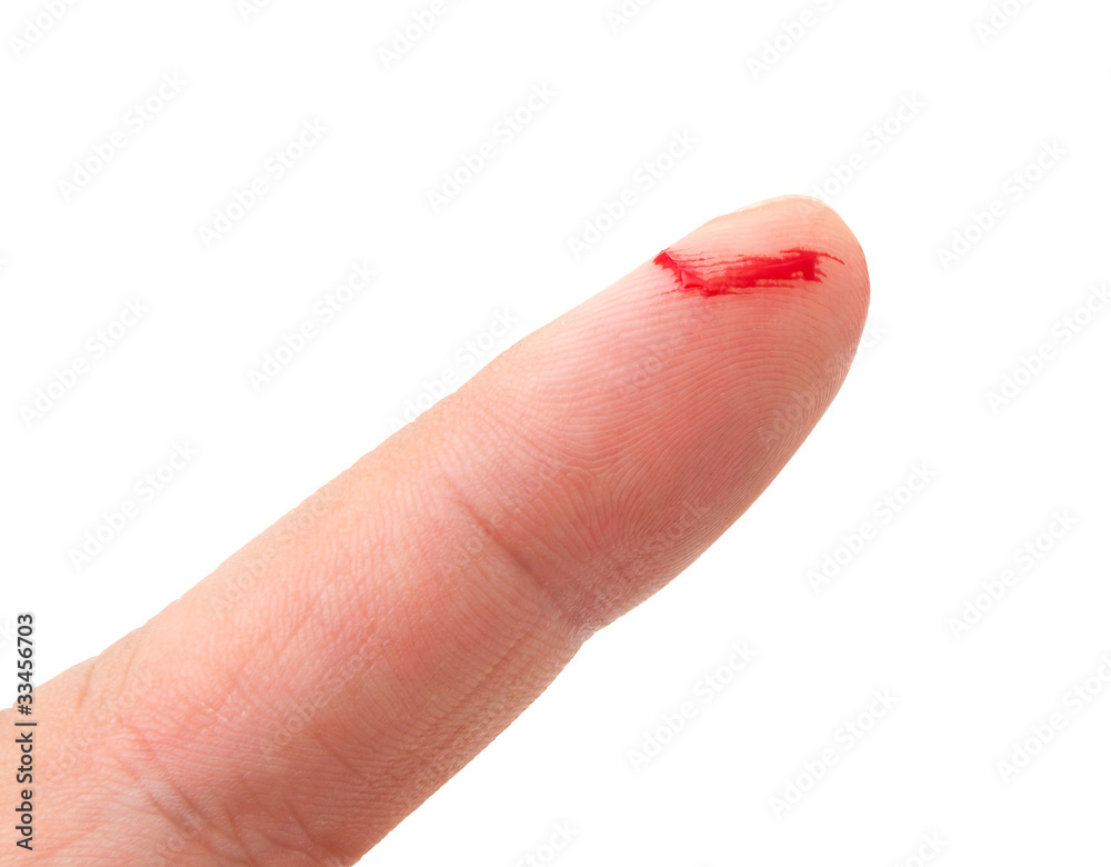 Bleeding from the cut finger Stock Photo | Adobe Stock