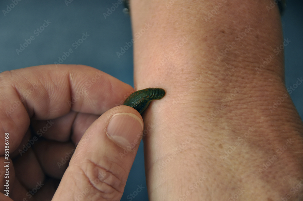 Medizinischer Blutegel Therapie Hirudo Stock Photo | Adobe Stock