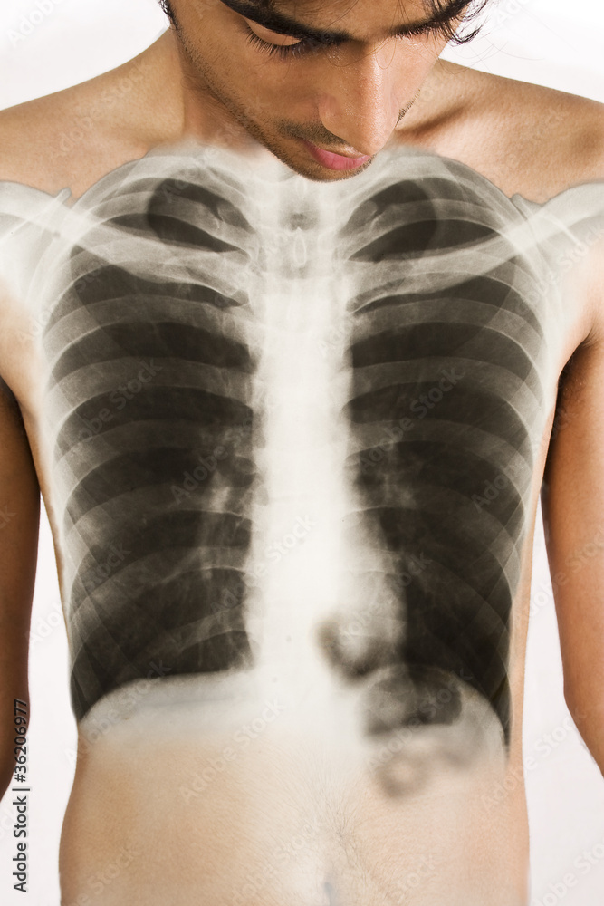 X ray of a man's chest visible on his body Stock Photo | Adobe Stock