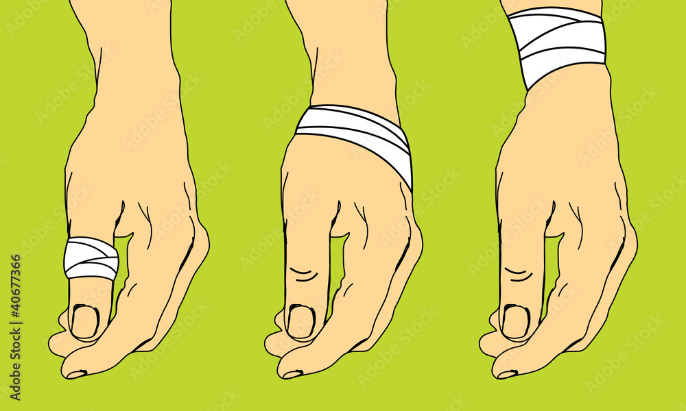 First aid for sprains. Stock Vector | Adobe Stock