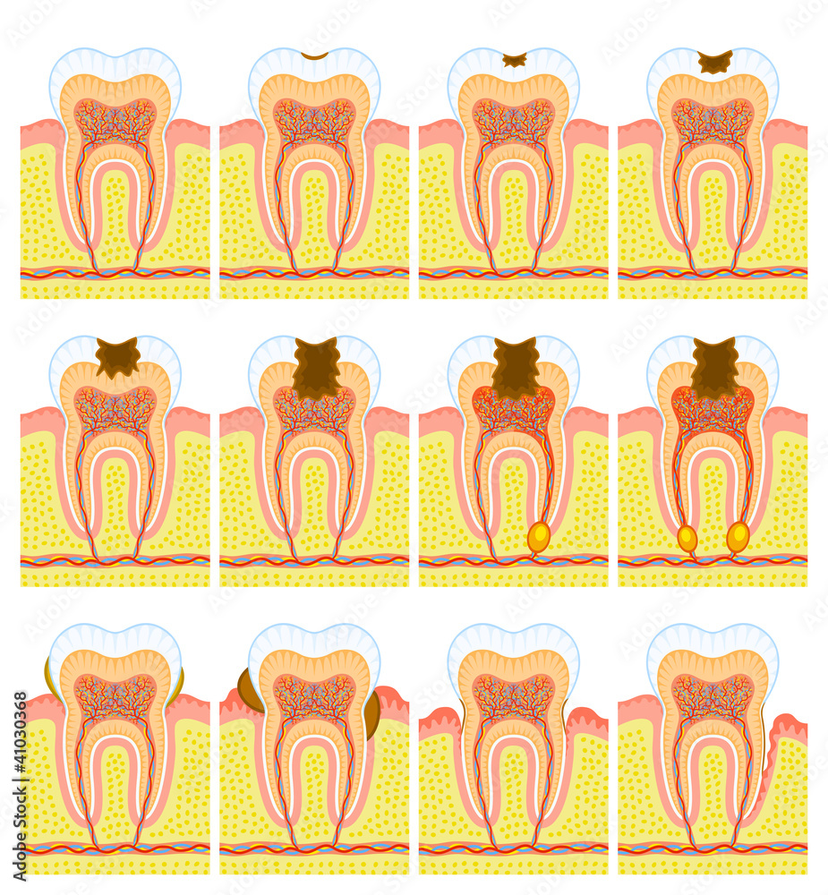 Internal structure of tooth Stock Vector | Adobe Stock