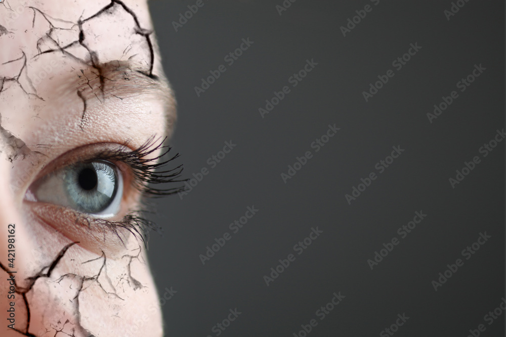 haut risse Stock-Foto | Adobe Stock