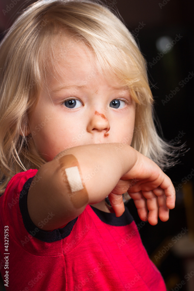 Injured boy with cut nose and adhesive bandage on elbow Stock Photo ...