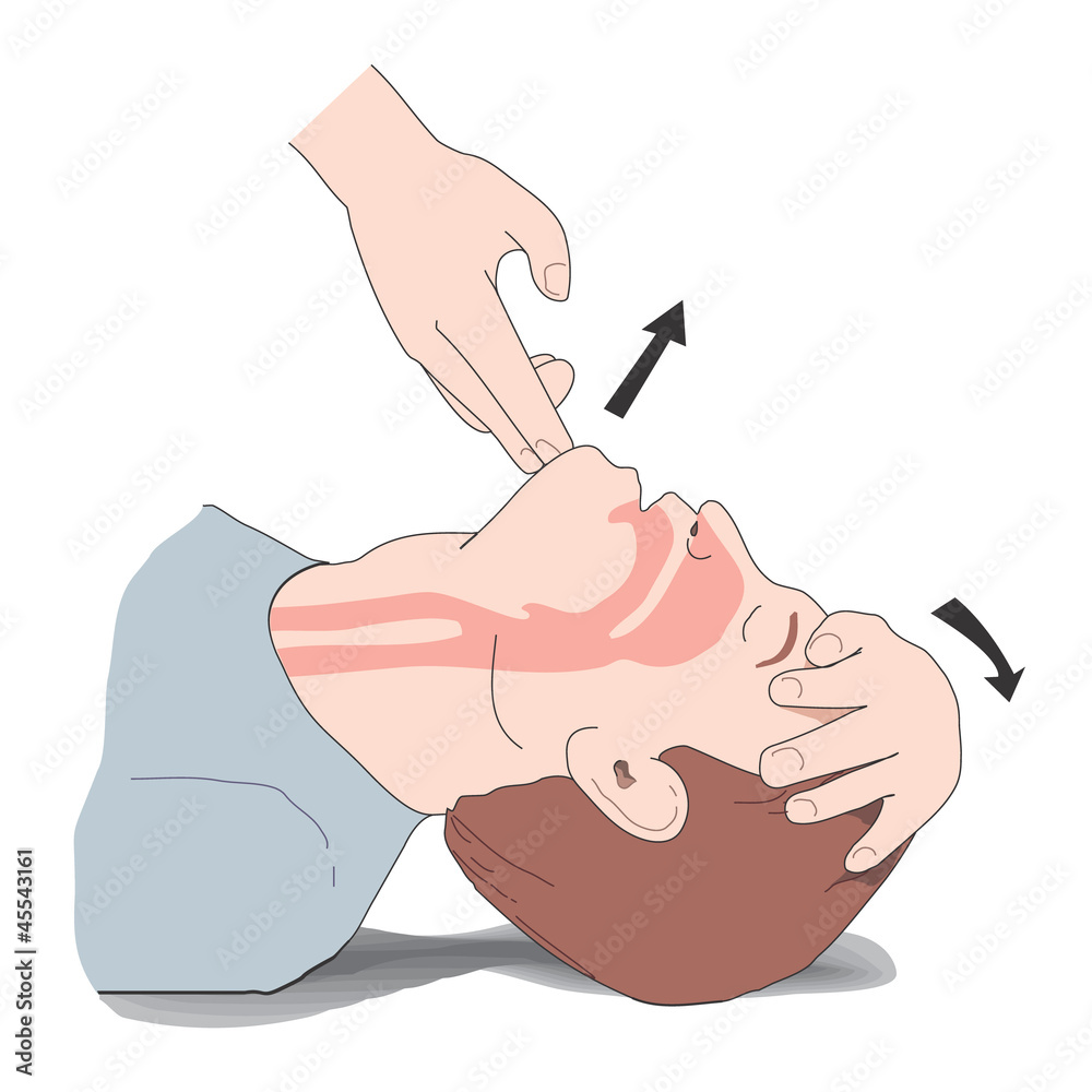 Method of First Aid, Artificial respiration, Reanimation Stock Vector ...