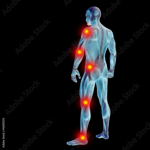 High resolution conceptual 3D human with inflammation wall mural ...