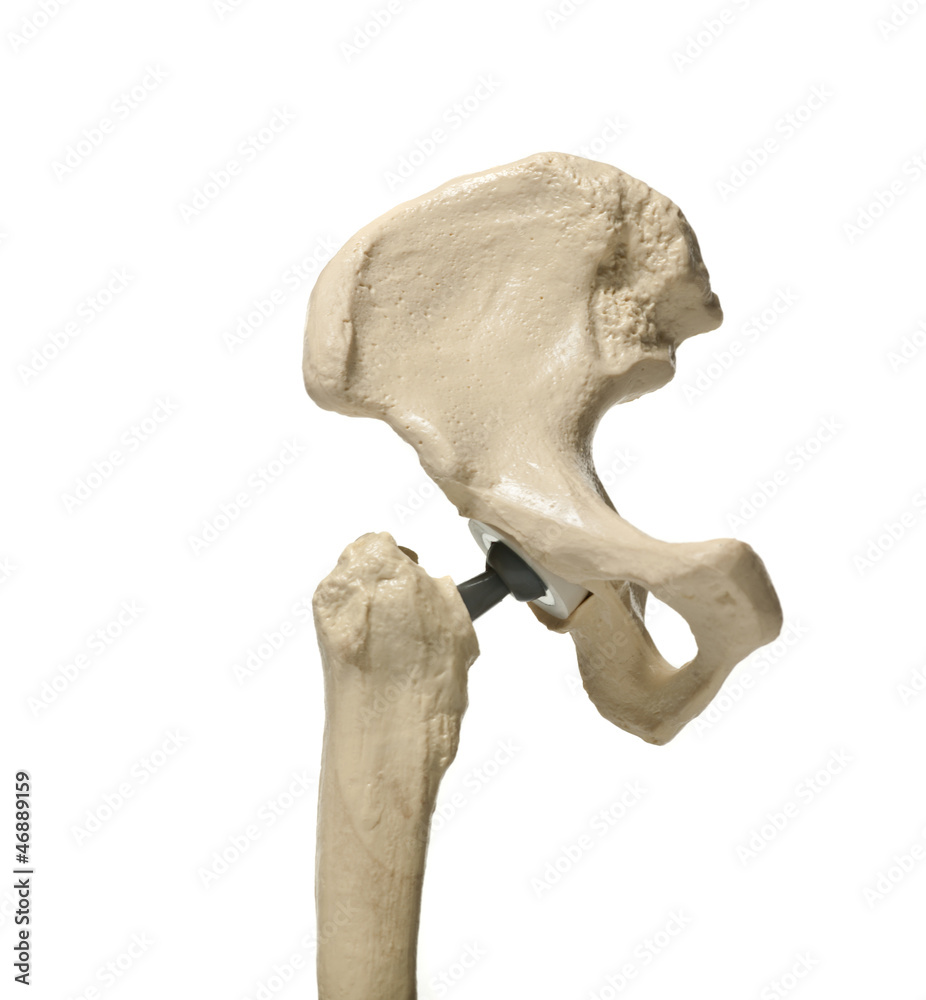 anatomic study model of an human hip replacement Stock Photo | Adobe Stock