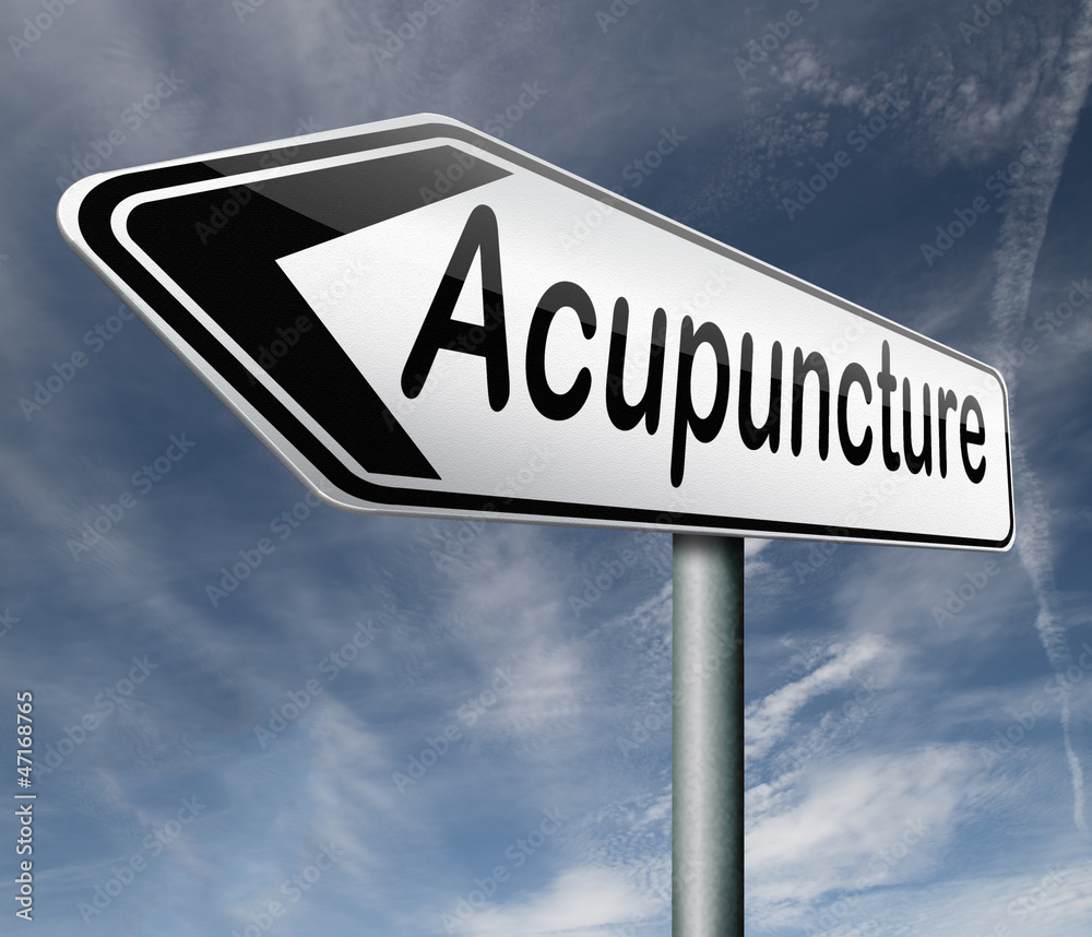 acupuncture Stock Illustration | Adobe Stock