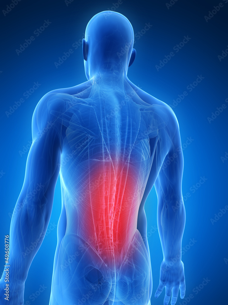 3d rendered illustration - painful back muscles Stock Illustration ...