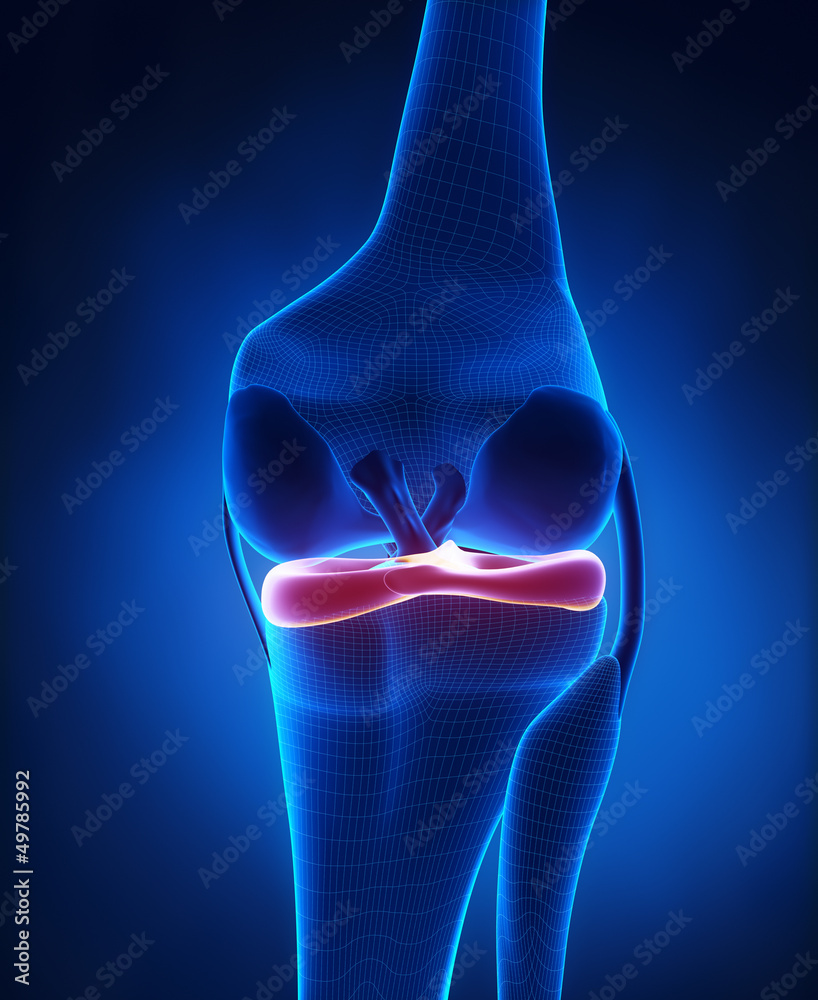 Lateral and medial meniscus anatomy Stock Illustration | Adobe Stock