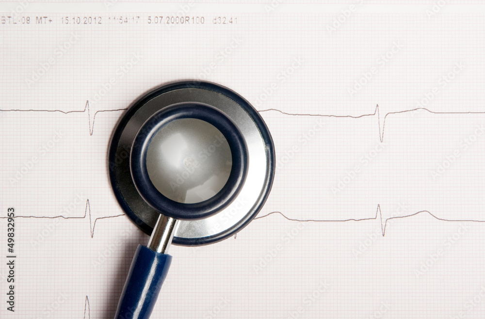 Stethoscope on ECG chart (electrocardiogram) Stock Photo | Adobe Stock