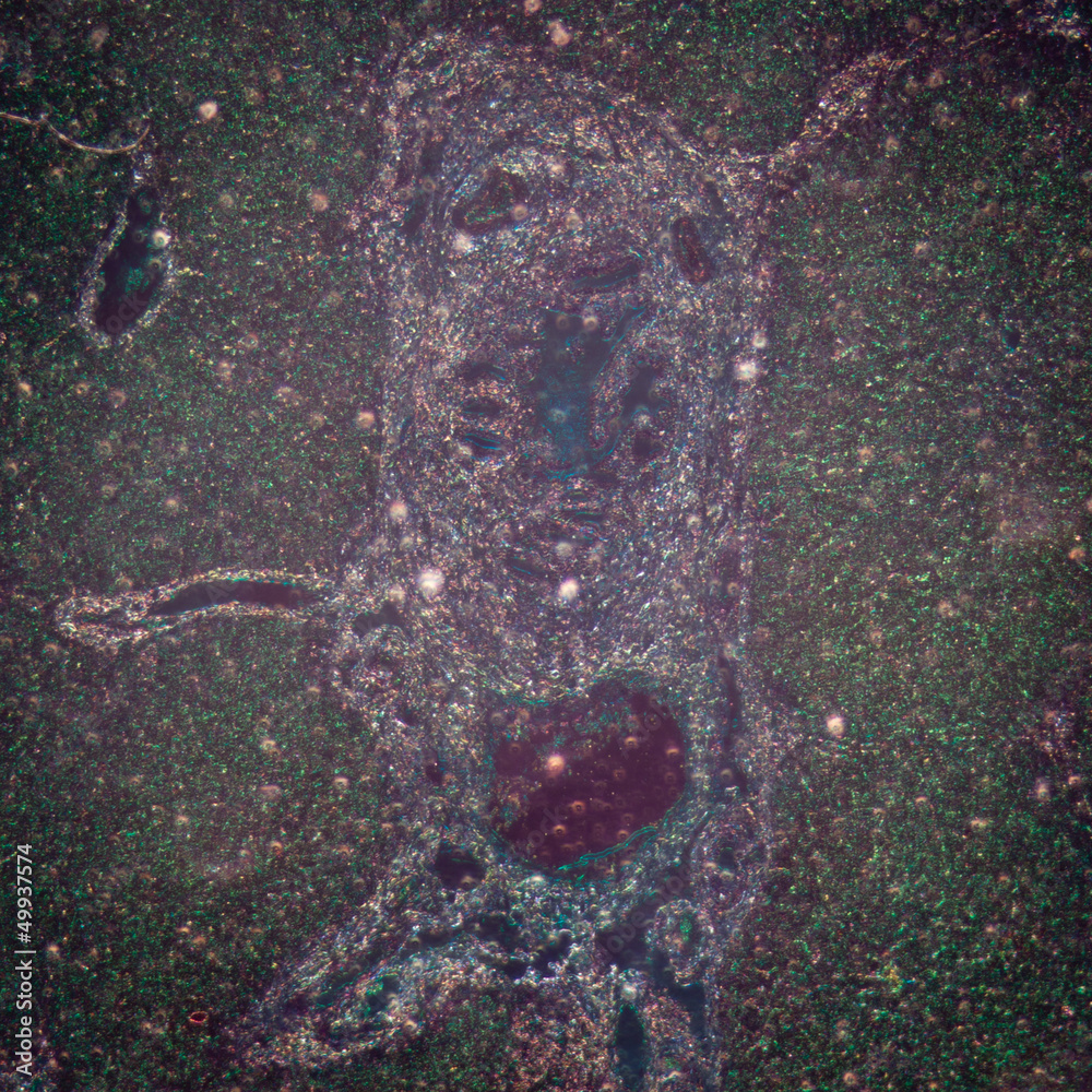 micrograph of liver tissue Stock Photo | Adobe Stock