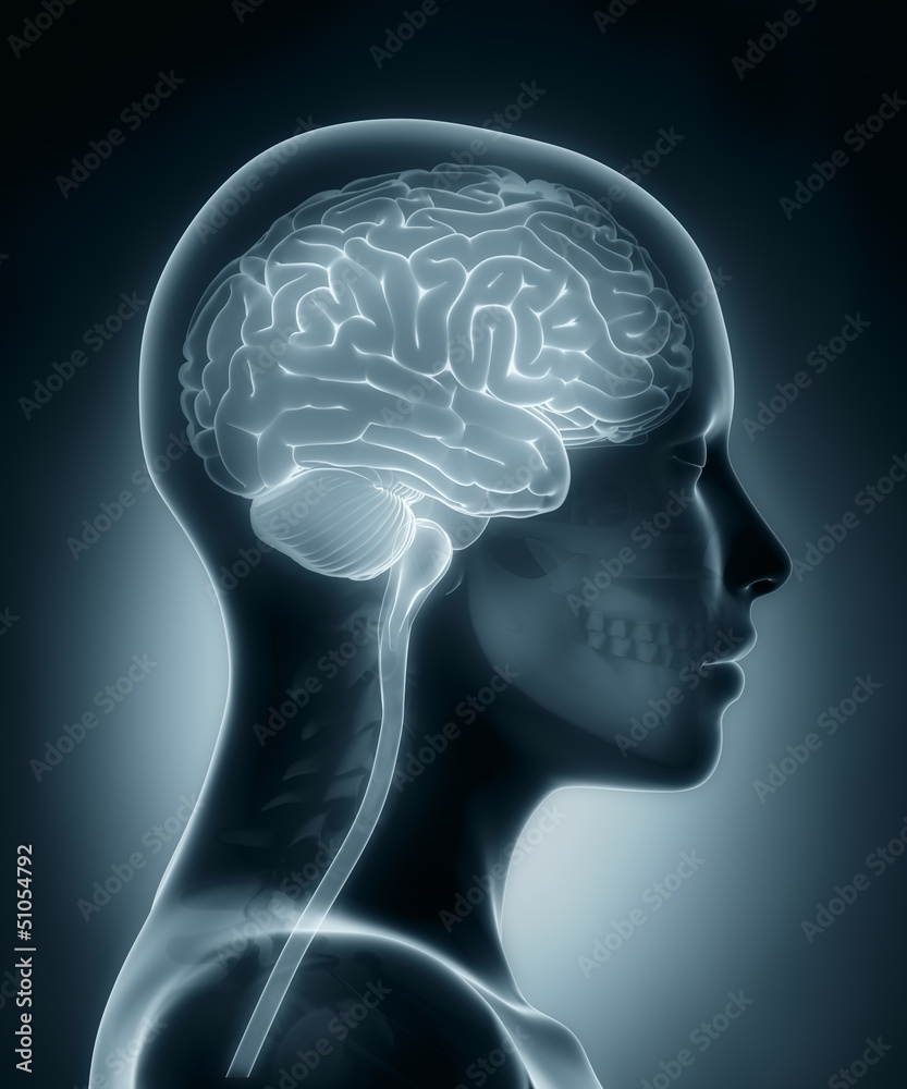 Female brain medical x-ray scan Stock Illustration | Adobe Stock