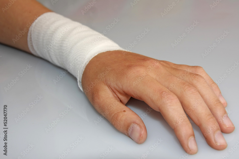 bandaged arm of a child because of a skin lesion Stock Photo | Adobe Stock
