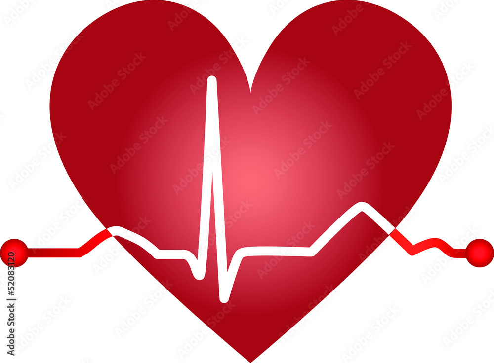 Ekg Herzstromkurve – Mengenal Elektrokardiogram (EKG), dari Fungsi ...