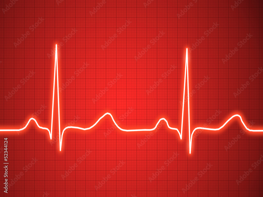 Electrocardiogram, ecg, graph, pulse tracing Stock Illustration | Adobe ...