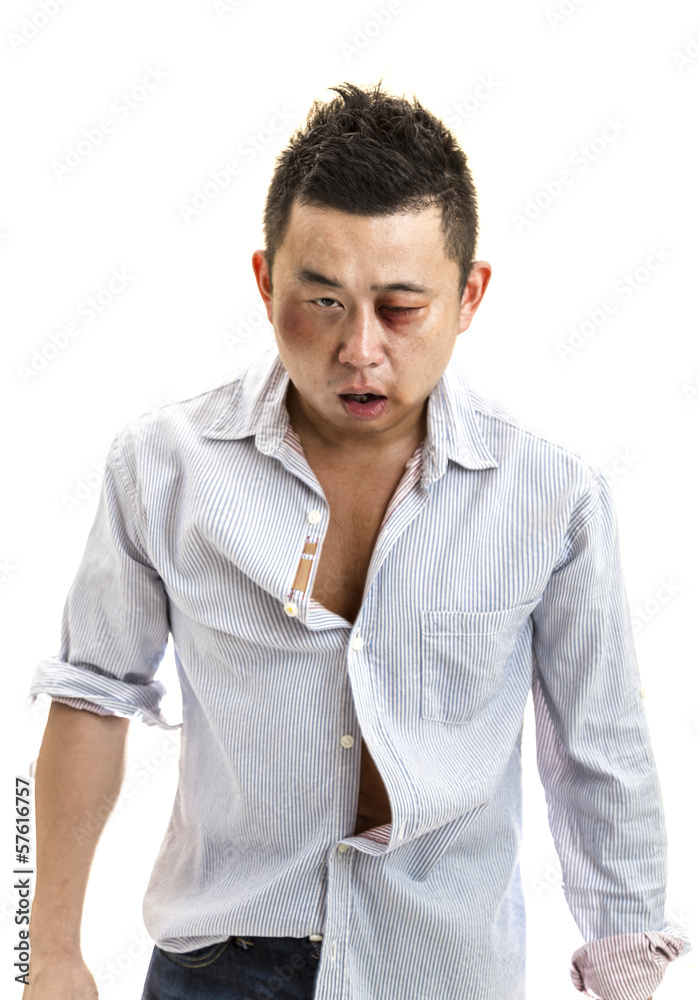 Wounded Man Stock Photo | Adobe Stock