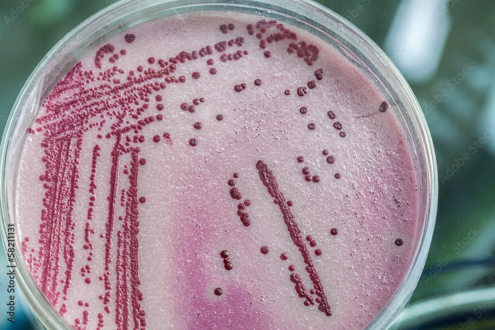 Pink and red microbacterias Stock Photo | Adobe Stock