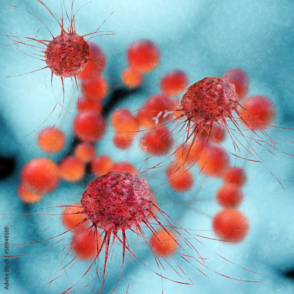 Cancer cells - 3d Rendering Stock Photo | Adobe Stock