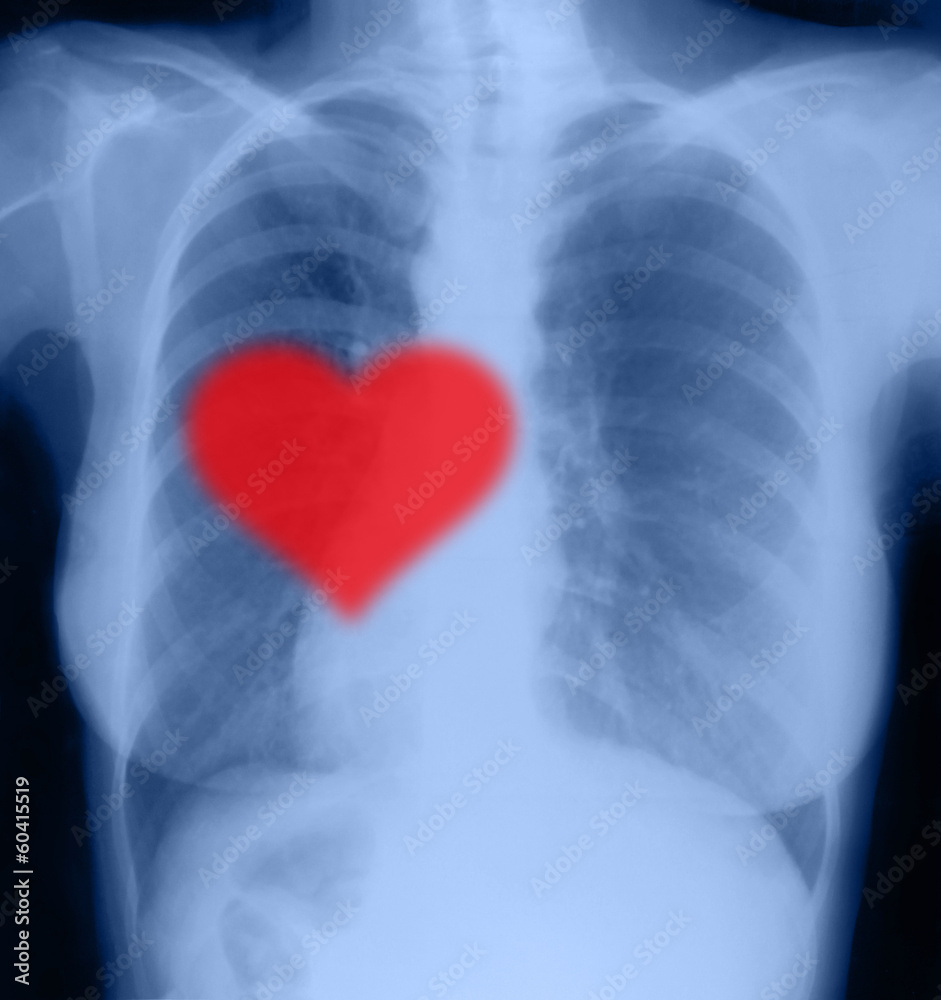 Red heart on x-ray chest Stock Photo | Adobe Stock