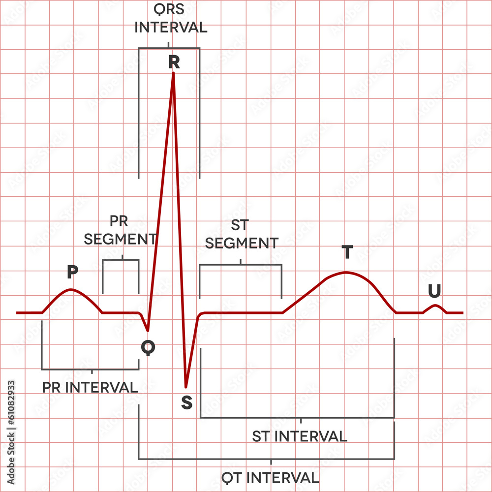 Human heart normal sinus rhythm, electrocardiogram Stock Vector | Adobe ...