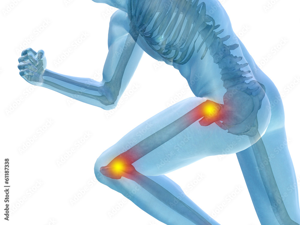 Conceptual human pain anatomy Stock Illustration | Adobe Stock