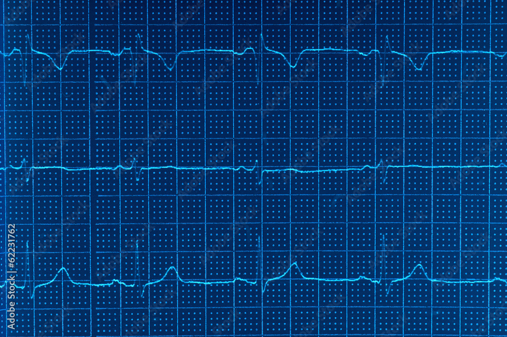 ECG Electrocardiogram Stock Photo | Adobe Stock