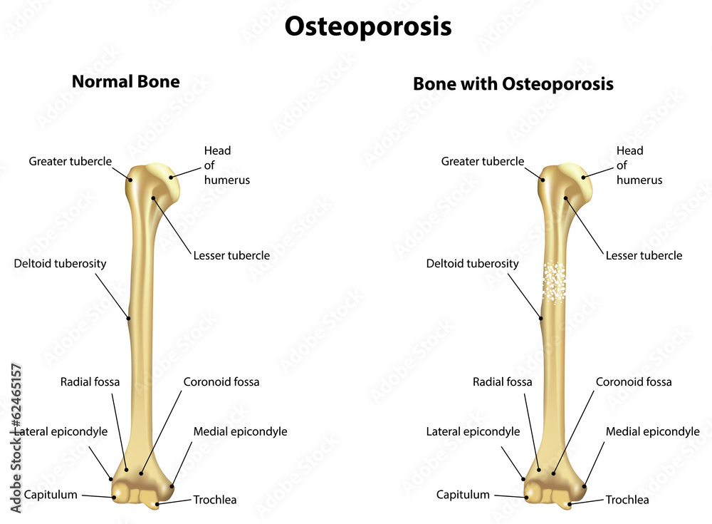 Humerus Diagram Labelled