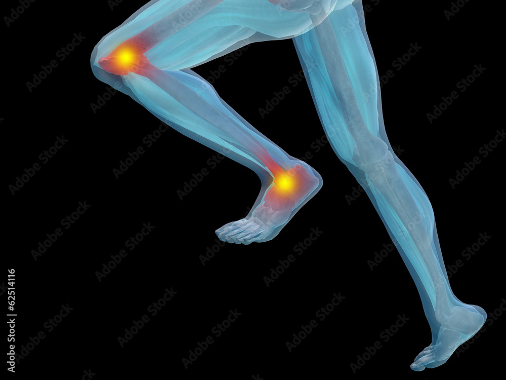 Conceptual human pain anatomy Stock Illustration | Adobe Stock