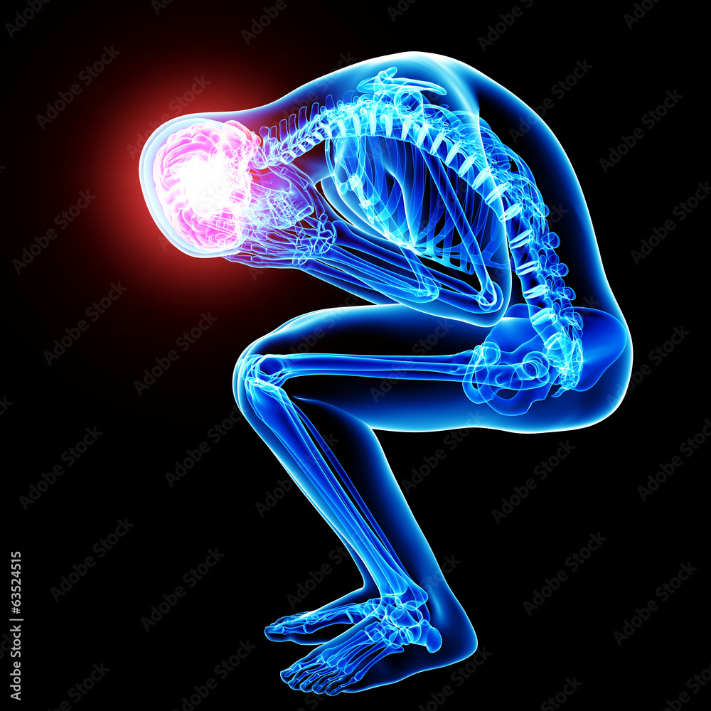 Anatomy of male brain pain in black Stock Illustration | Adobe Stock