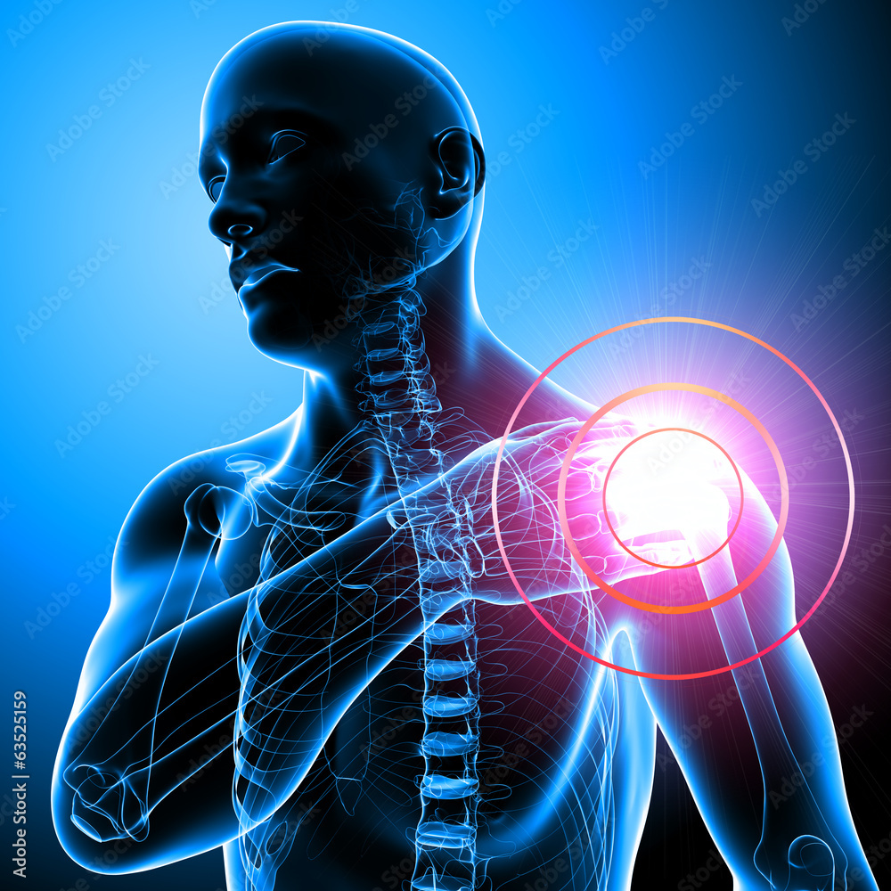 Anatomy of male Shoulder pain in blue Stock Illustration | Adobe Stock