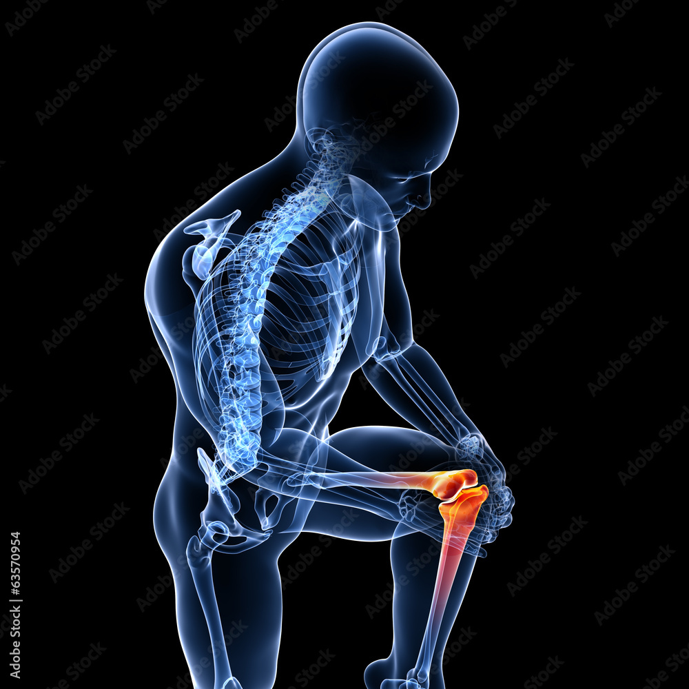 Anatomy of male knee pain in black Stock Illustration | Adobe Stock