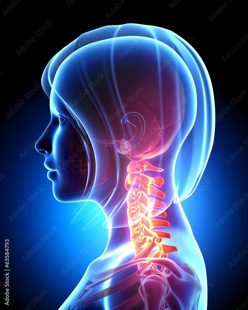 3d Anatomy of female neck pain Stock Illustration | Adobe Stock