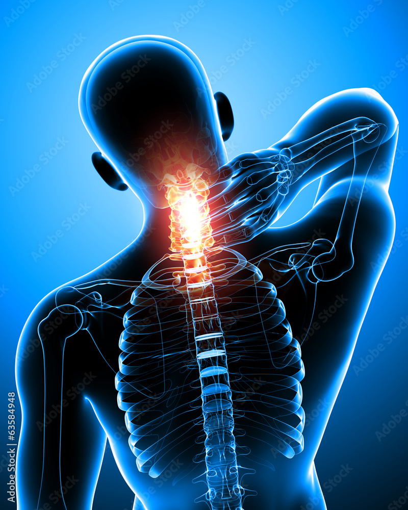 male neck pain anatomy in blue Stock Illustration | Adobe Stock