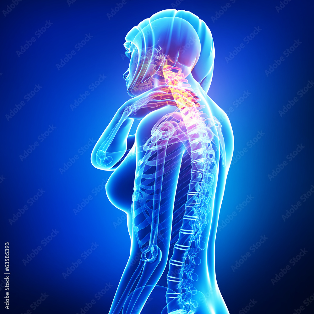 Anatomy of female neck pain in blue Stock Illustration | Adobe Stock