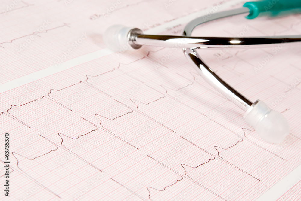 Poster Stethoscope on an electrocardiogram (ECG) chart – Wall Art ...