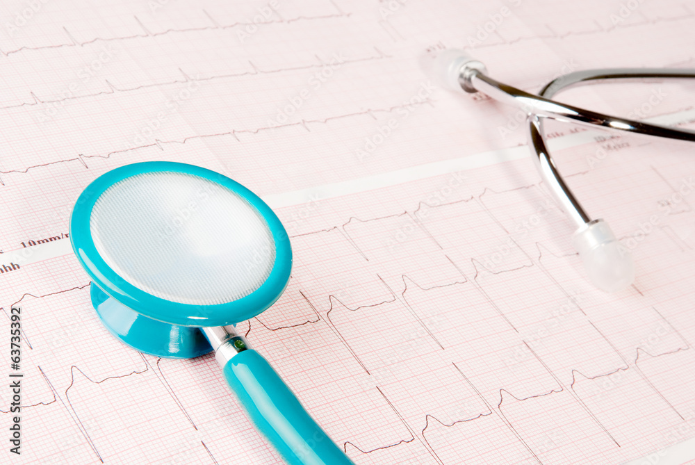 Stethoscope on an electrocardiogram (ECG) chart Stock Photo | Adobe Stock