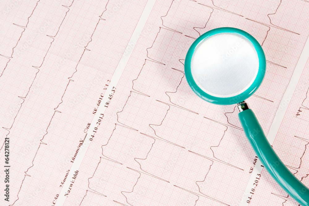 Stethoscope on an electrocardiogram (ECG) chart Stock Photo | Adobe Stock